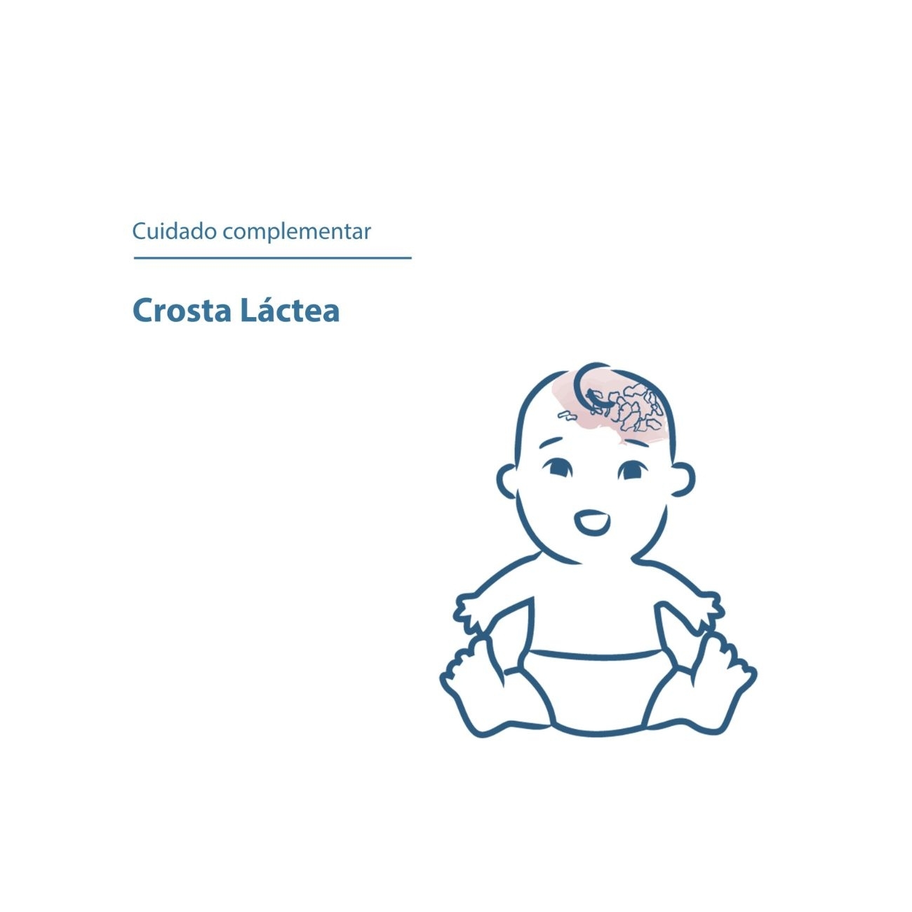 Ducray Kélual Emulsão Crosta Láctea 50ml